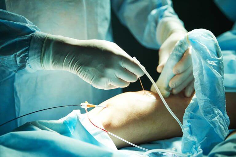 What Benefits do you seek by Undergoing Vascular Surgery? - Health Eveready